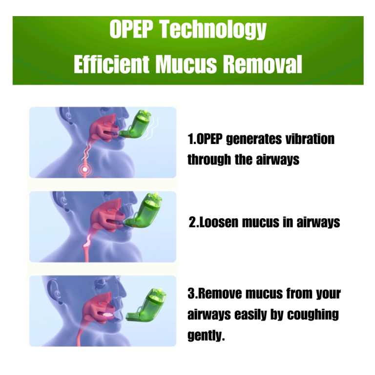 B-Arm Mucus Removal Device & Lung Expander using OPEP Technology, Drug ...